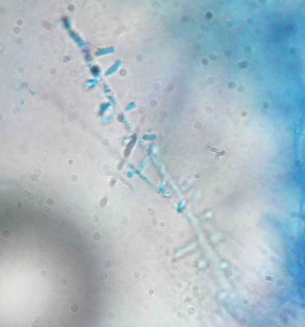 ATLAS MICOLOGIA: TRICHOPHYTON INTERDIGITALE
