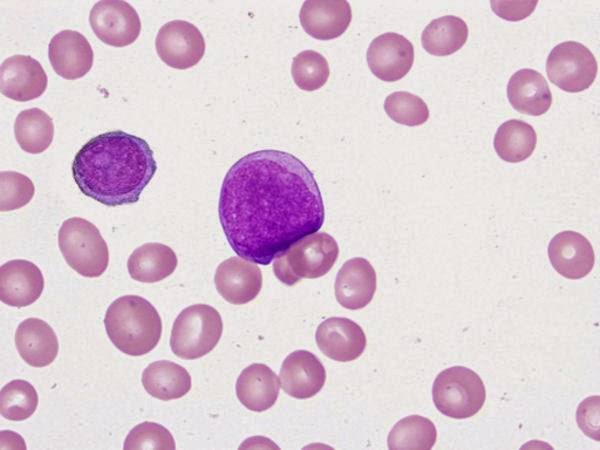 Medical Laboratory and Biomedical Science: Hematology Challenge