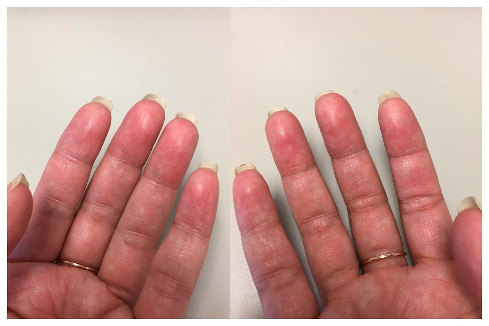 My Nail Growth Journey and the Best Tips and Tricks for Treating Your Nails