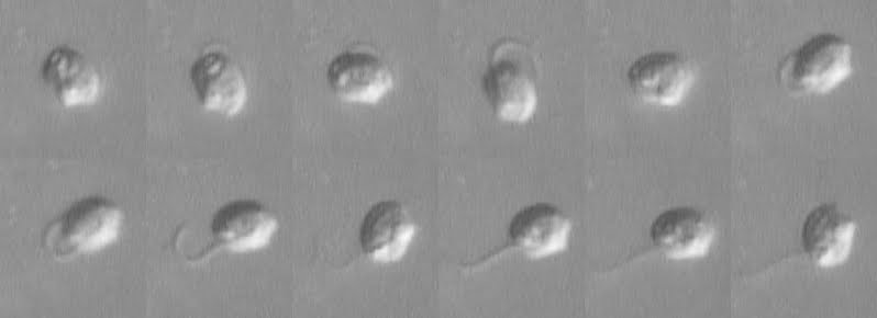 Skeptic Wonder: Out in the field: freshwater microforay picture dump