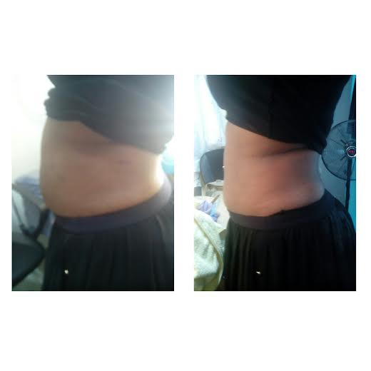 Shed off excess fat and get the best shade of skin colour without any ...