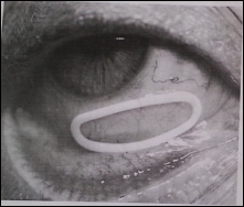 Romz Presentations.: Pharmacology practical dosage images