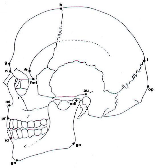 ANTROPOLOGÍA FORENSE: CRANEOMETRIA