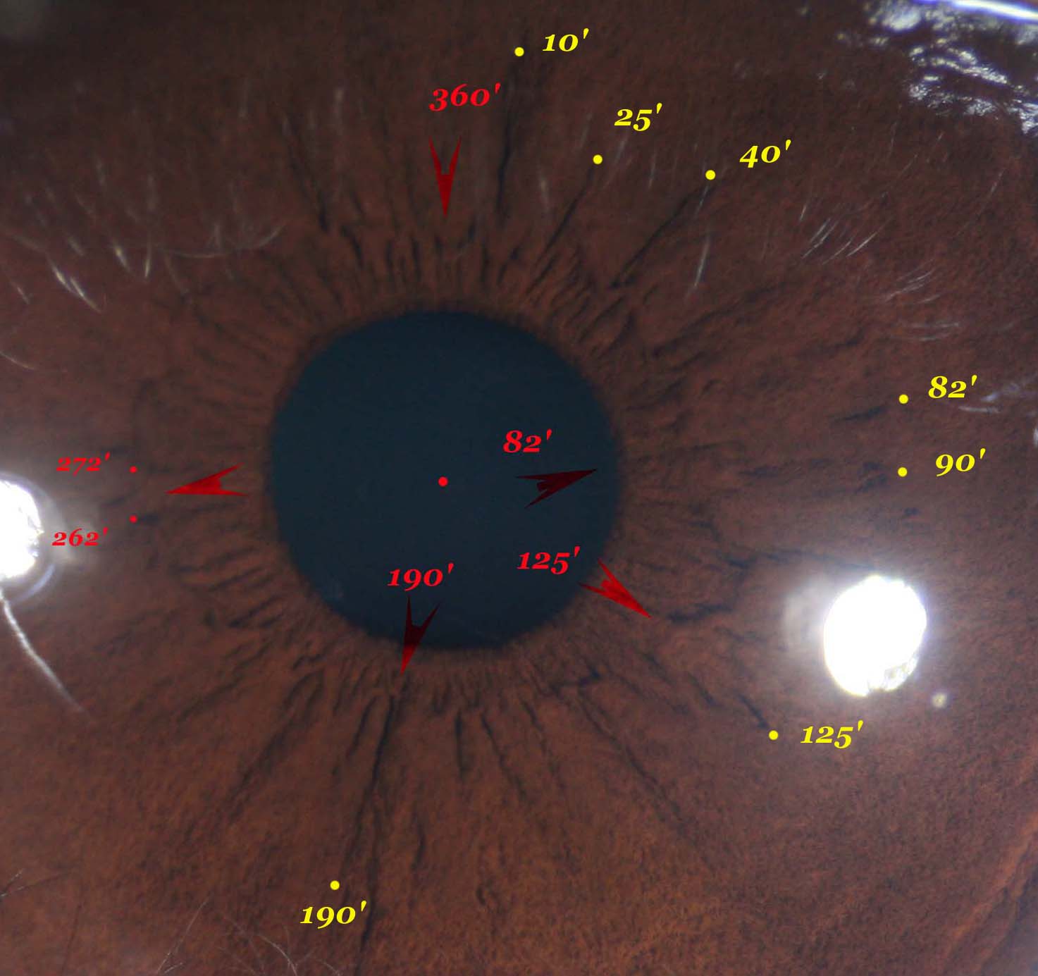 Modern & Multidimensional Iridology: The Integrity of the Collarette ...