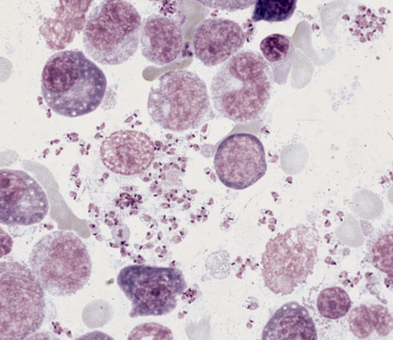 fichero hematologia: Leishmania