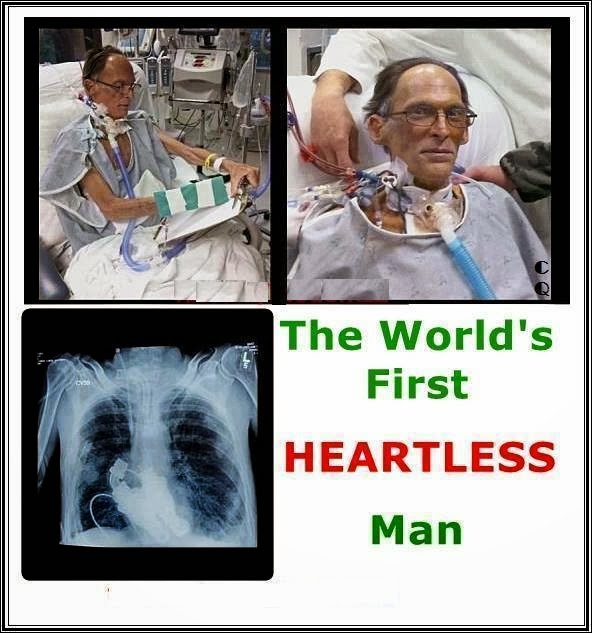 JL Company : THE FIRST HEARTLESS MAN IN THE WORLD