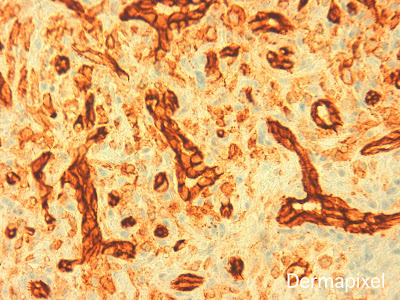 Dermapixel: mayo 2019