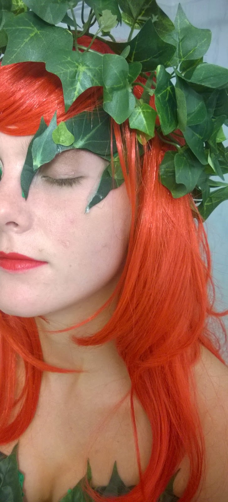 Poison Ivy Eyelid Treatment at Alison Mclemore blog