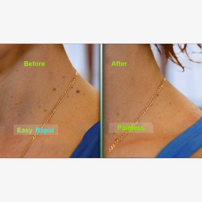 Sani Skin Reviews - Tbuy.in