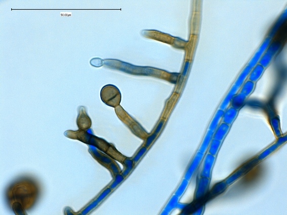 Fun With Microbiology (What's Buggin' You?): Stemphylium species