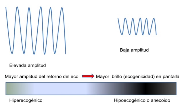 Ecografía: FORMACIÓN DE LA IMAGEN ECOGRÁFICA (Ecogenicidad de los tejidos)