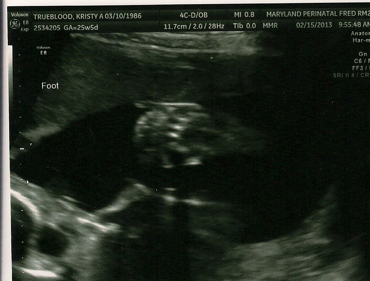 Jason and Kristy: 3rd Trimester Perinatology Ultrasound