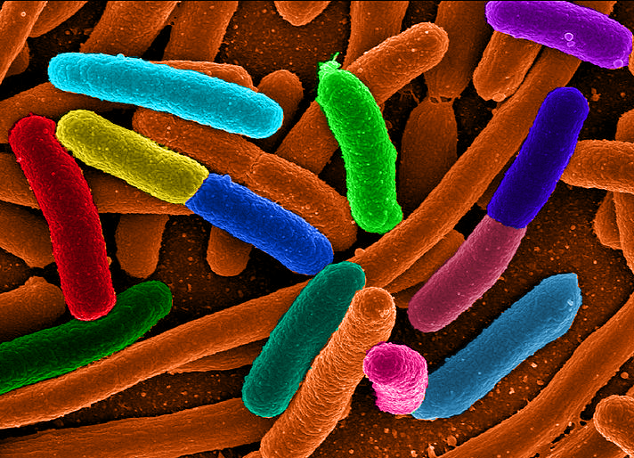 ΦΥΣΗ - ΓΕΩΡΓΙΑ - ΙΣΤΟΡΙΑ: Escherichia coli