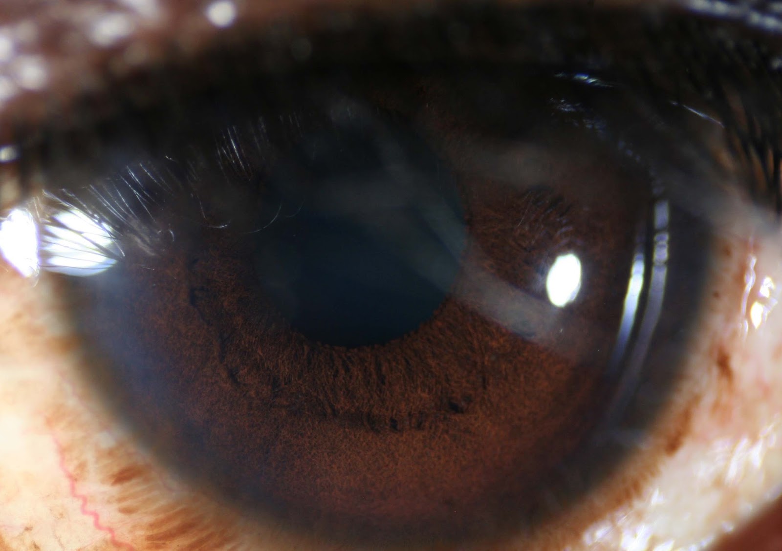 Modern & Multidimensional Iridology: Iris Signs at Pupillary Zone - (Lx ...