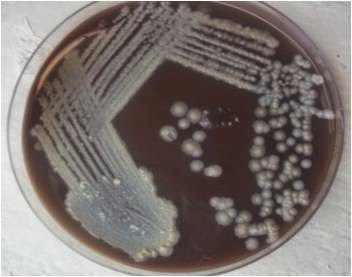 UREAPLASMA UREALYTICUM IN MALE : Streak plate technique in blood agar ...