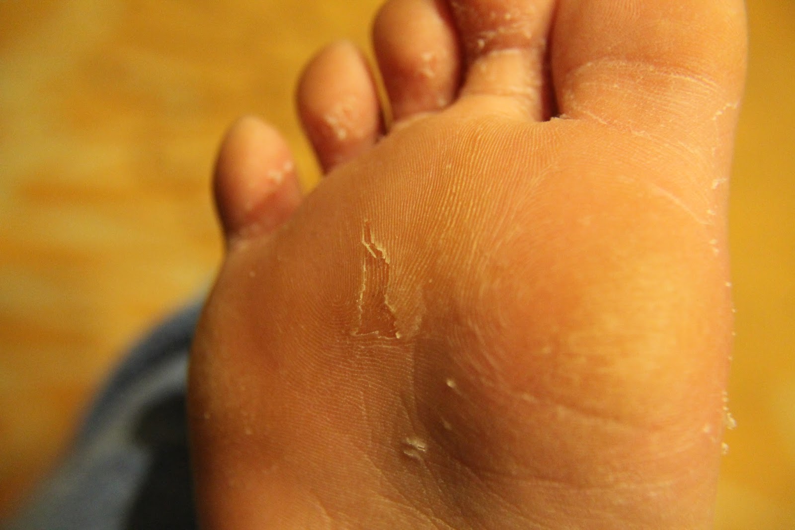 Wiktoria Gajewska: Magic Foot Peel - zadbane stopy