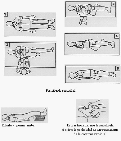 Cuidados y Tecnicas de Enfermería: PACIENTE INCONSCIENTE: PRIMEROS AUXILIOS