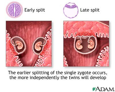 Everything About Twin Babies