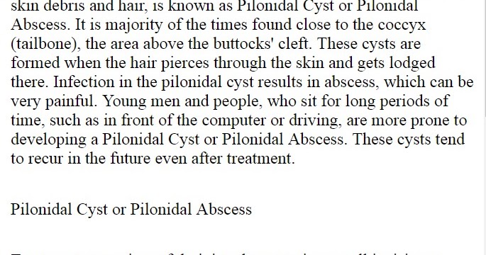 Pilonidal Cyst or Pilonidal Abscess: Causes, Risk Factors, Symptoms ...