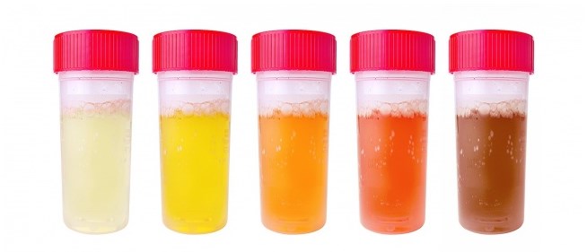 Curiosidades e dicas: 7 FATOS QUE A URINA INDICA SOBRE A SAÚDE DO SEU ...