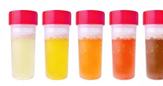 Curiosidades e dicas: 7 FATOS QUE A URINA INDICA SOBRE A SAÚDE DO SEU ...