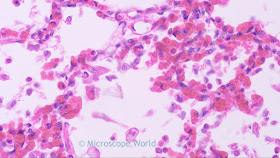 Microscope World Blog: Penumonia under the Microscope