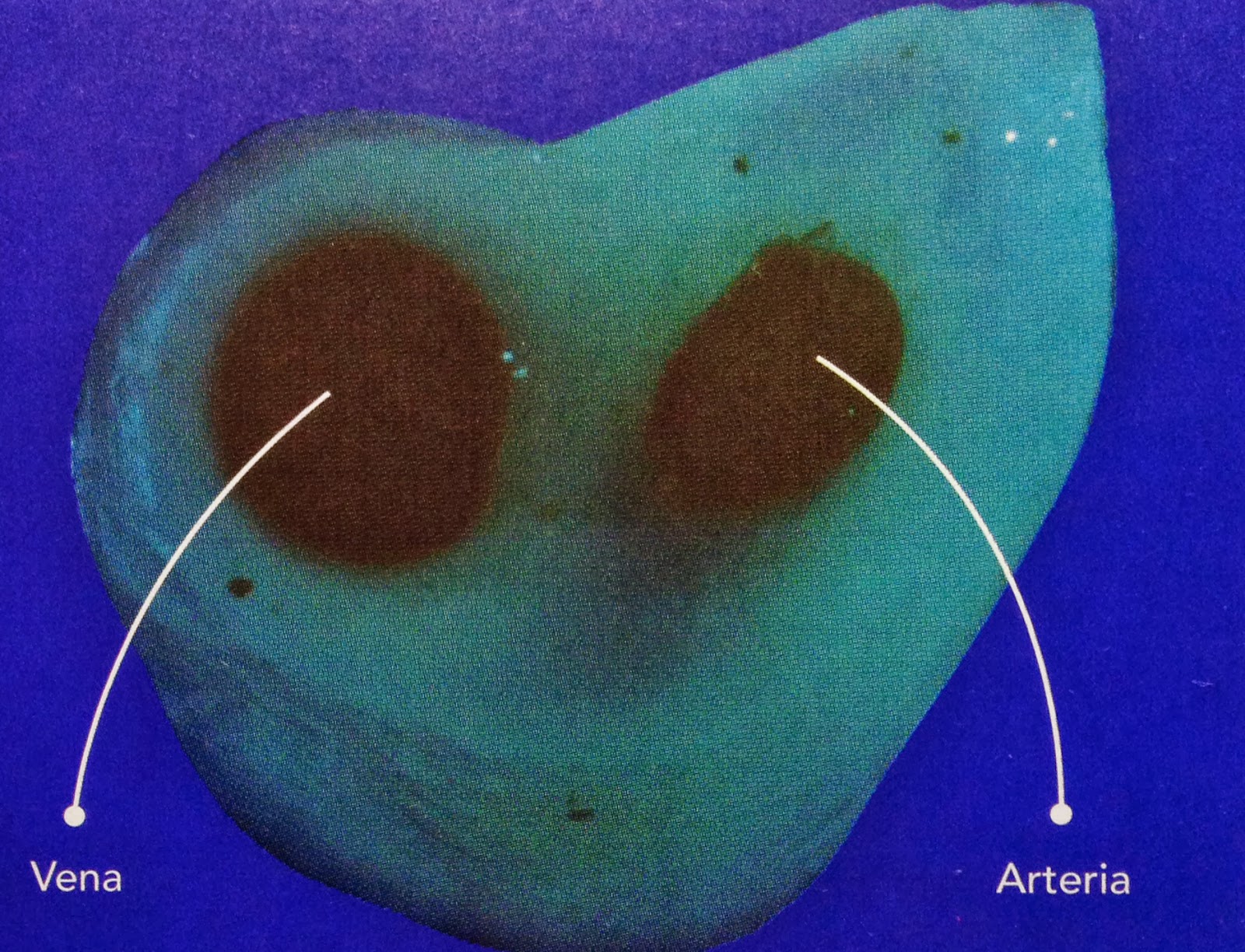 Embriología ENMH: Cordón Umbilical