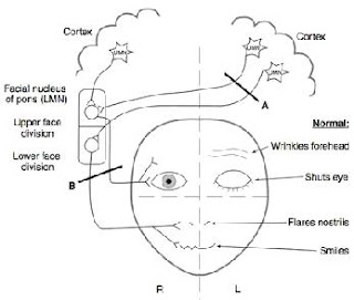 Vital Areas in The Brain: Upper motor neuron lesion affected to face ...