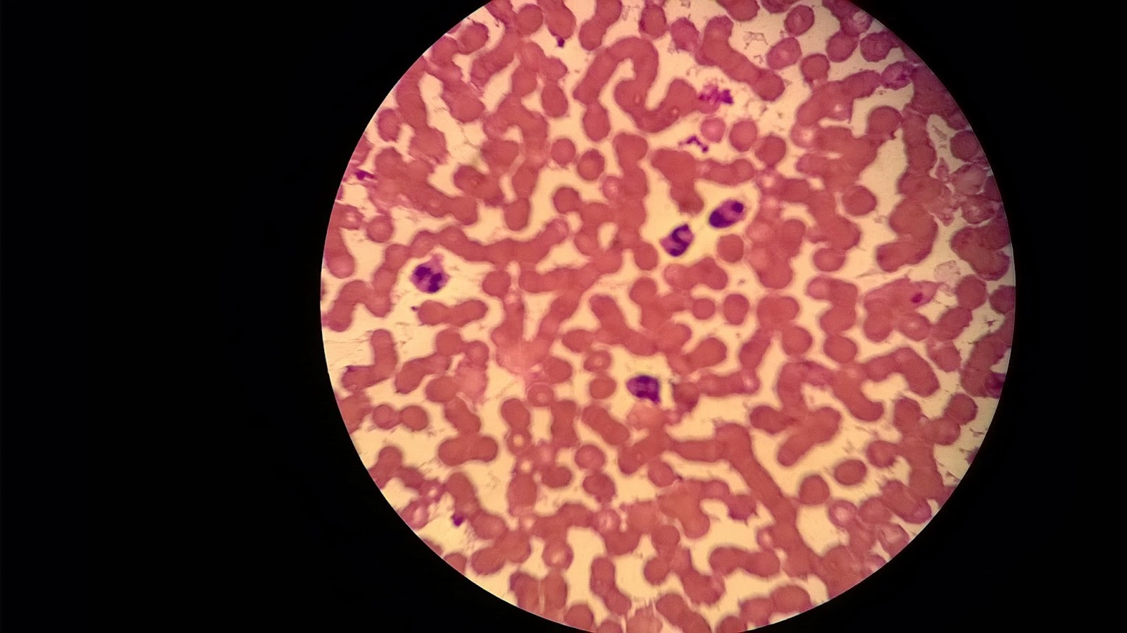 Cuaderno de prácticas de hematologia: Fórmula leucocitaria (01 de ...