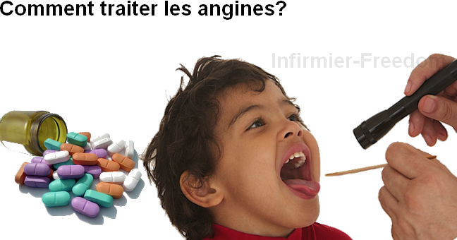 Comment traiter les angines? ~ Santé et les soins infirmiers