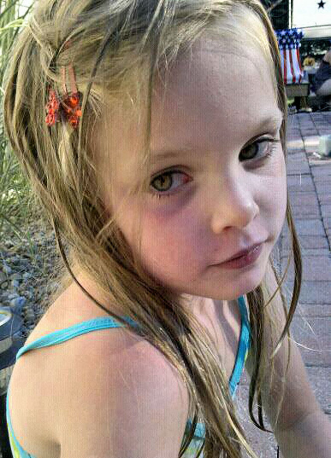 A Million Points Of Light, Darkened: Lauren Belius