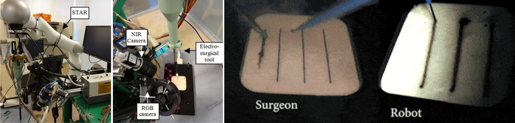 New results with the Smart Tissue Autonomous Robot (STAR)