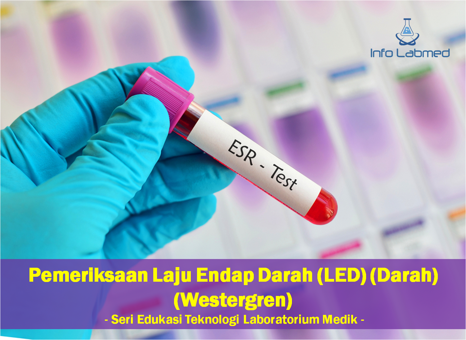 Pemeriksaan Laju Endap Darah (LED) (Darah) (Westergren)
