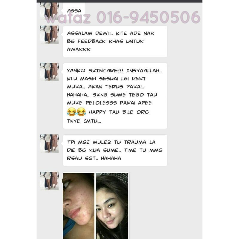 Natural Health Be Young: TESTIMONI YANKO SKINCARE