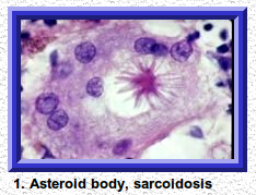 Medical Resource Links: Atlas of Granulomatous diseases by Yale Rosen