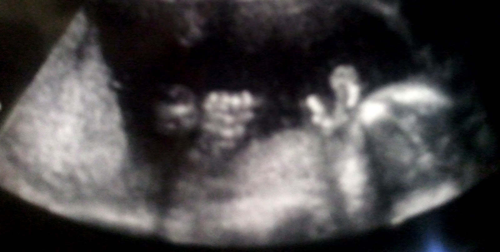 From motherhood and beyond by a Latin Girl: 19 weeks pregnant