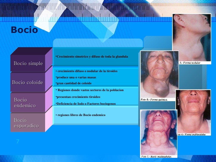 Casos clínicos. Farmacología en nutrición ~ BITÁCORA DE UNA ESTUDIANTE ...
