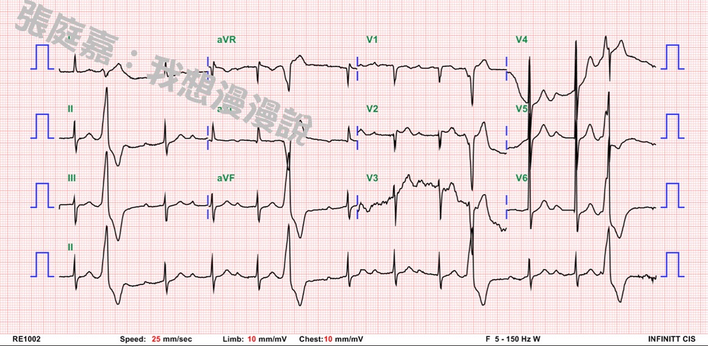 傻傻分不清楚：VPC還是APC？