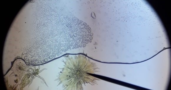 Trikoma pada Daun Durian