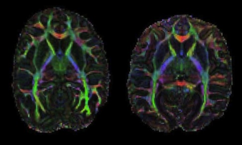 eScienceCommons: Chimps, bonobos yield clues to social brain