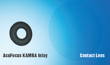 AcuFocus KAMRA Inlay to correct near sightedness without bifocals ...