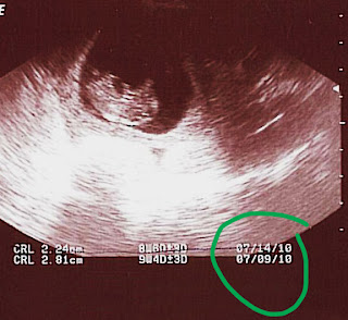 Parenting the Preemie Pope: My Little 23 Weeker?