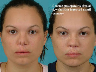 Dr. Dean Toriumi Reviews: Dean Toriumi: Cleft Lip and Reconstructive ...