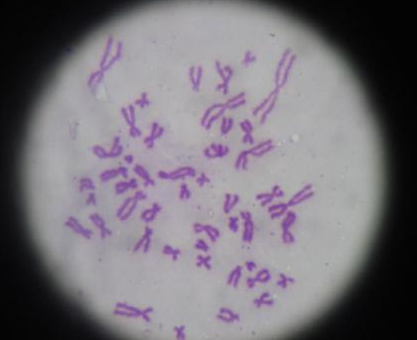 Genética Agronômica: Os Cromossomos Sexuais e o Porquê do Nome ...