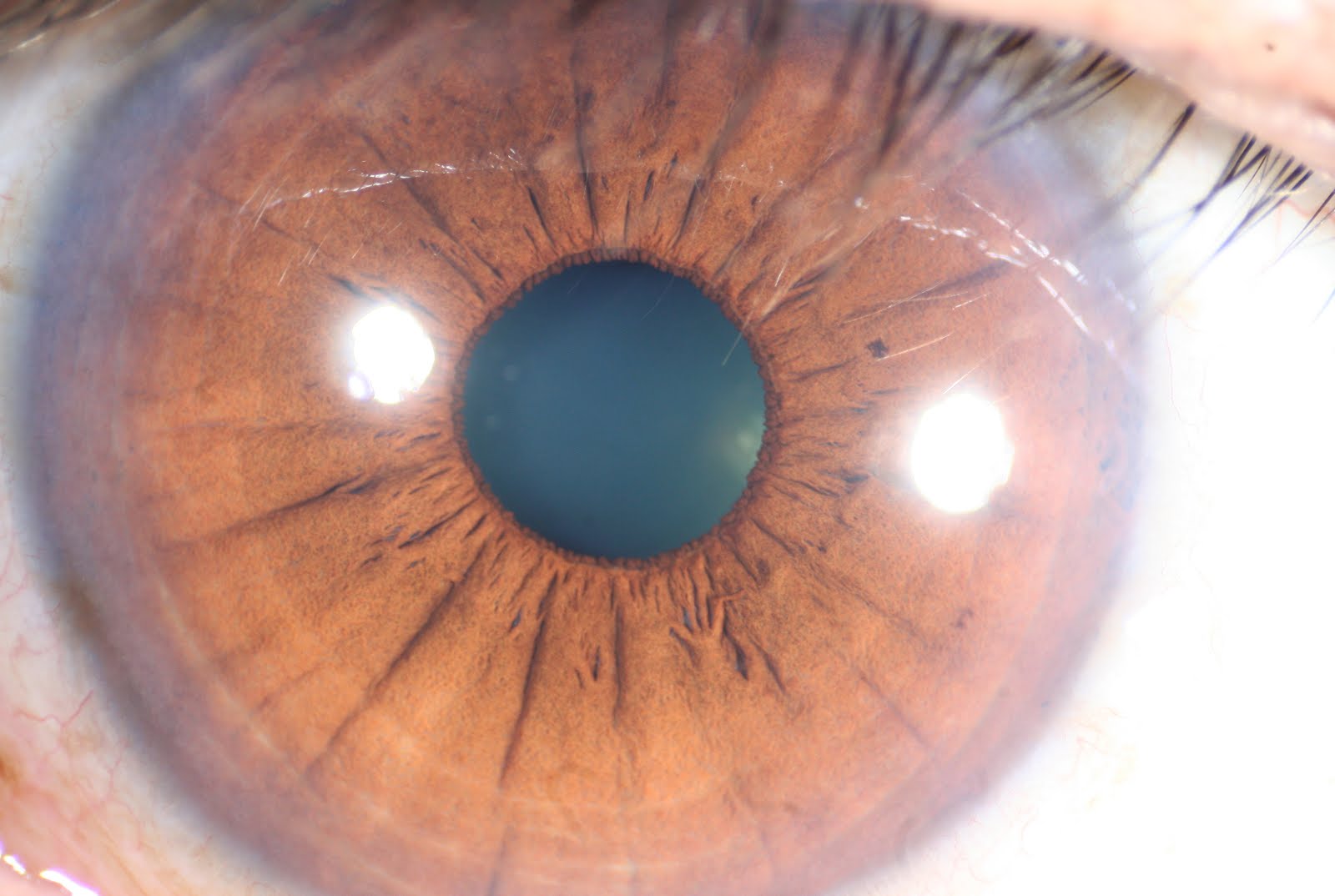 Modern & Multidimensional Iridology: Multidimensional approach in B1 ...