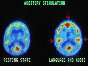 Musical expressions of Joy: How Music Affects Memory