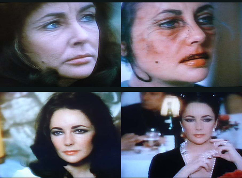 Elizabeth Taylor Plastic Surgery