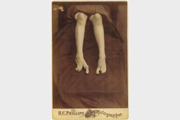 9 Bizarre and Shocking Medical Images from History ~ Eyes-Popping ...