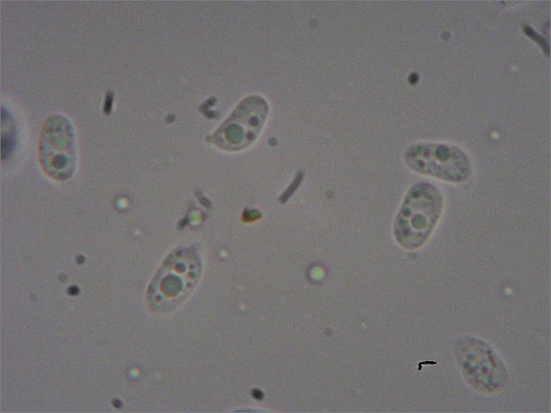 Misidentifying Fungi: In a High Weald churchyard