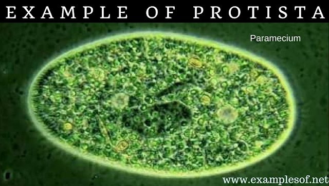 20 Examples of Protozoa (Protista) | Kingdom Protista